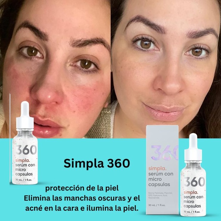 Pack 3 Simpla 360 - HB STORE PERU